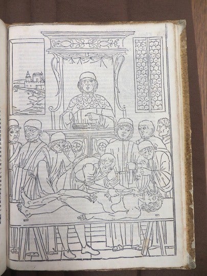 First Blood Transfusion: A History - JSTOR Daily